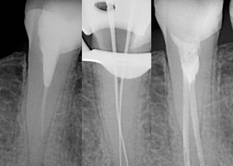 Panoráma röntgen - 360 Dental Fogászat és Szájsebészet Budapest ...